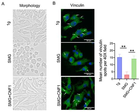 Focal Adhesion Kinase Alleviates Simulated Microgravity Induced
