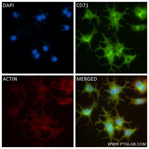 Cd71 Antibody 84766 3 Rr Proteintech