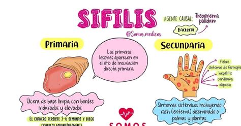 Etapas De La SÍfilis Infografias