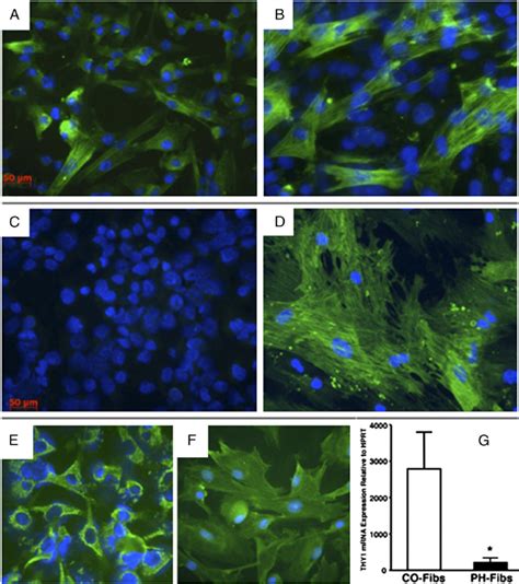 Phenotypic Characterization Of Ex Vivo Pulmonary Adventitial Fibroblast