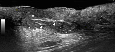 Dermatologic Ultrasound Radiology Key