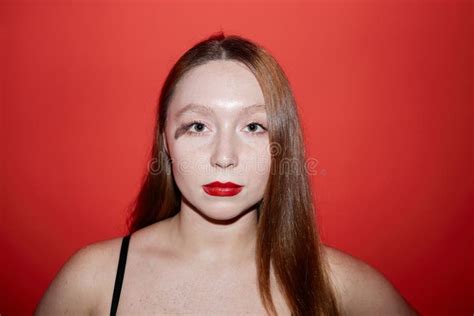 Portrait Of Girl With Birthmark On Face Wearing Red Lipstick While