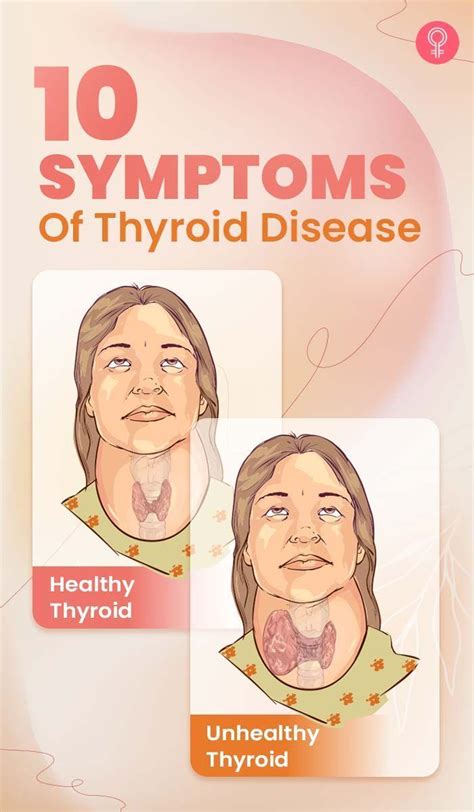 16 Signs Of Thyroid Problems In Women You Should Know Plus How To