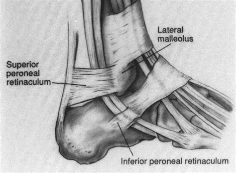 Peroneal Retinaculum Wikism Sports Medicine Wiki