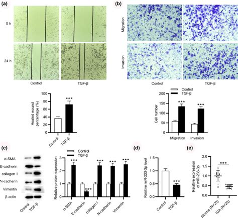 Tgf β Facilitates Emt Process And Ecm Deposition And Downregulates