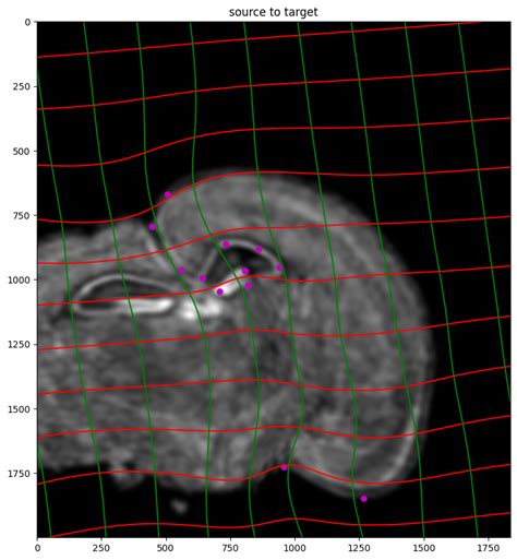 Aligning Single Cell Resolution Spatial Transcriptomics Data To Hande Staining Image From Visium