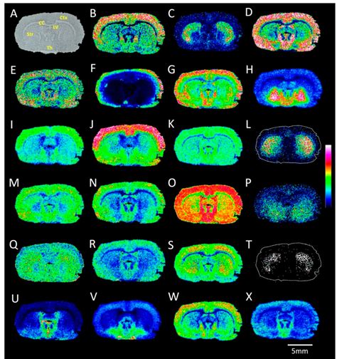 On Tissue Chemical Derivatization For Comprehensive Mapping Of Brain Carboxyl And Aldehyde