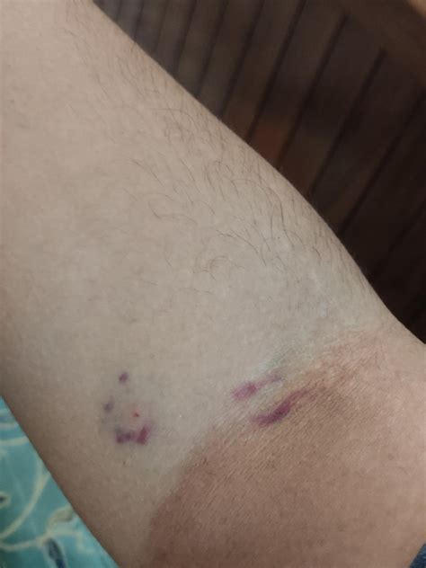 Platelets Donation Rblooddonors