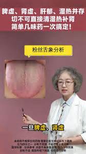 一旦脾虚、肾虚、肝郁、湿热并存,切不可直接清湿热补肾 一旦脾虚、肾虚、肝郁、湿热并存,切不可直接清湿热补肾