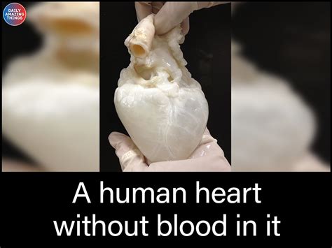 Amazing Things This Heart Has Been Decellularized Facebook
