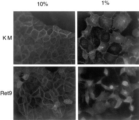 Immunostaining For E Cadherin Shows Tight Cellular Junctions In Km And