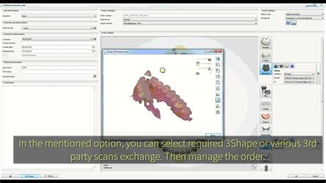 Trios And 3rd Party Software Scans Import Workflow In 3shape Youtube Trios And 3rd Party Software Scans Import Workflow In 3shape Youtube