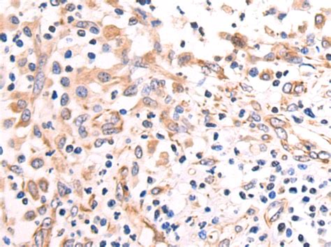 兔抗mff多克隆抗体anti Mff Rabbit Polyclonal Antibody 生命科学产品与技术服务 生工生物工程上海股份有限公司