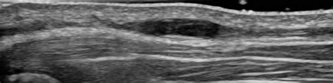 Peripheral Vessels 102 Peripheral Veins Case 1025 Venous System