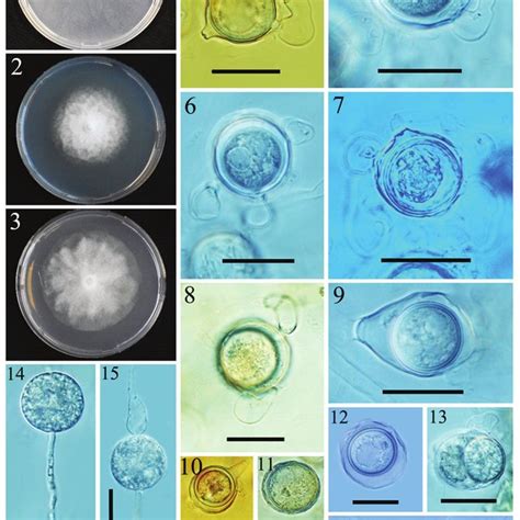 Pythium Sylvaticum 1 Colony Morphology Of The Isolate Opu 1702 On Cma