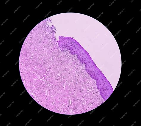Premium Photo Histological Examination Of Uterus Biopsy Suggestive