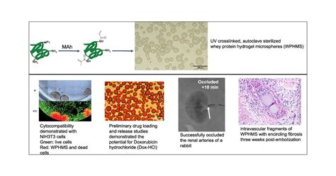Whey Protein Based Hydrogel Microspheres For Endovascular Embolization