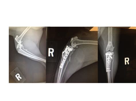 Transverse Stress Fracture Of The Proximal Tibia In A Cat With Non