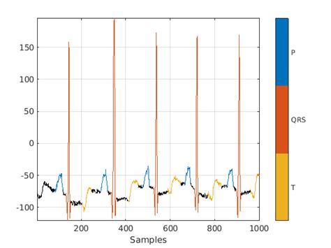 matlab 波形片段切割 使用深度学习进行波形分割 csdn博客