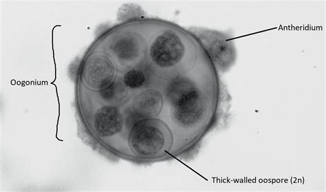 2422 Oomycota Biology Libretexts