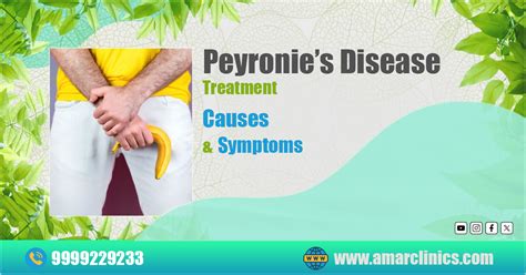 Peyronies Disease Amar Clinic
