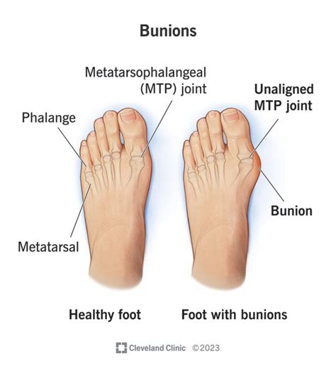 Mal Sook Ko Feet