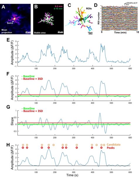 Spatiotemporal Analysis Of Microglial Ca2 Activity At Single Cell Resolution Protocol