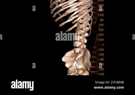 Mastoid Process Of Temporal Bone Stock Videos And Footage Hd And 4k