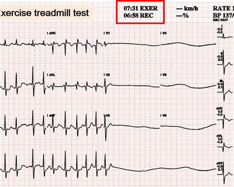 대한심장호흡재활의학회지annals Of Cardiopulmonary Rehabilitation