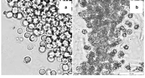 Light Microscope Image Of Cavitated A And Uncavitated B Microcystis