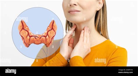 Woman Self Touching Her Neck To Check The Thyroid Gland With Close Up Showing Enlarged Thyroid