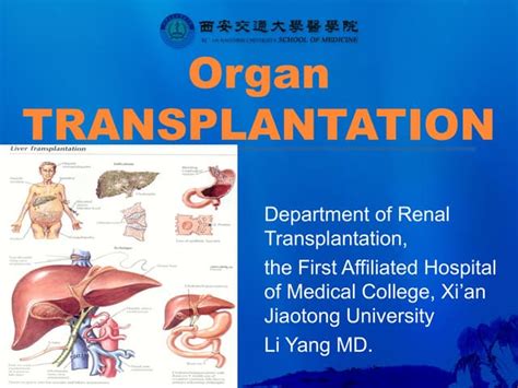 transplantation ppt