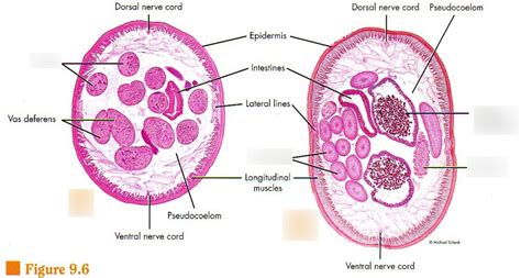 Phylum Nematoda Cross Sections Ascaris M F Roundworm Diagram Quizlet