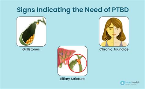 PTBD Procedure Steps Full Form Stenting Radiology Test