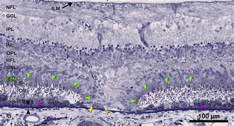 Photomicrograph Showing The Descent Of The External Limiting Membrane
