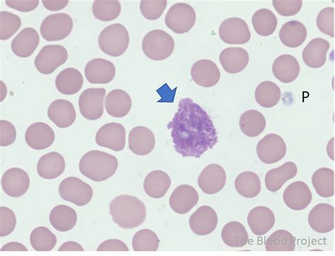 Smudge Cells • The Blood Project