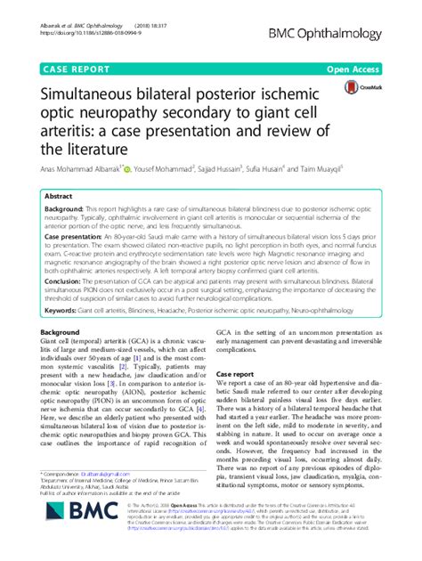 Pdf Simultaneous Bilateral Posterior Ischemic Optic Neuropathy