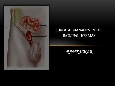 Lymph Nodes Examination Pptx