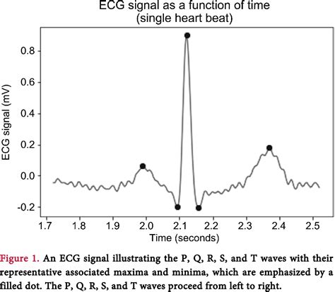 Figure 1 From Preliminary Biometrics Of Ecg Signal Based On Temporal