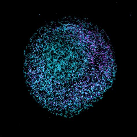 Organoid Intelligence