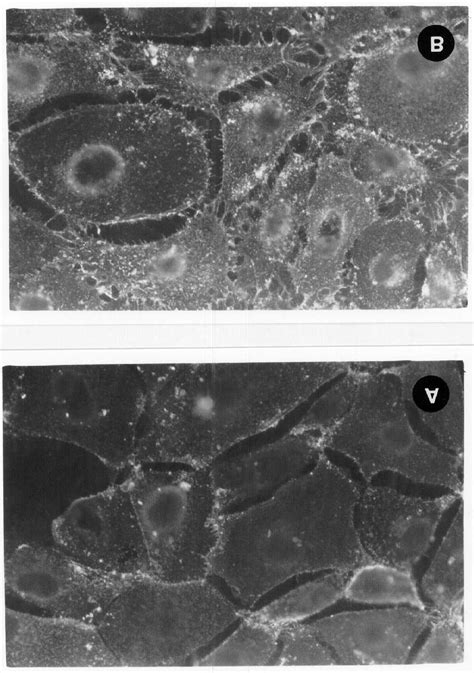 Fluorescence Assay Of Ma 104 Cell Cultures Incubated With Cona Fitc