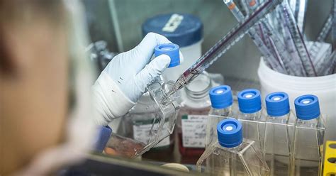 Detectan En Cataluña Un Caso De Tuberculosis Extremadamente Resistente