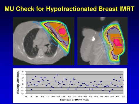 Ppt Independent Dose Verification For Imrt Using Monte Carlo