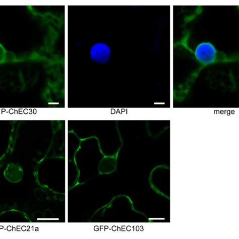 Confocal Microscope Z Stack Projections Showing The Localization