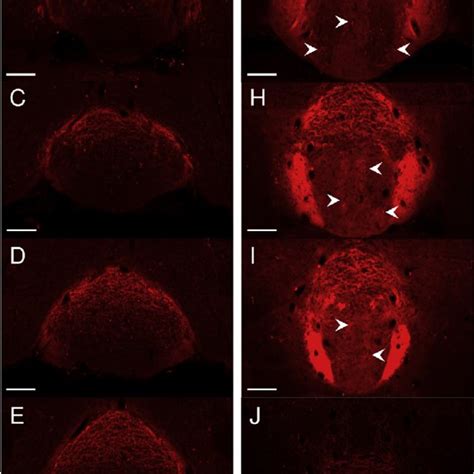 Expression Of ␣ 5 Gfp And ␣ 5 Mrna In The Interpeduncular Nucleus A