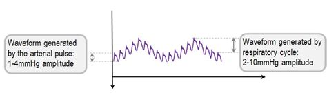 Interpretation Of Intracranial Pressure Waveforms Deranged Physiology
