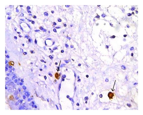 Immunohistochemical Staining Of Ifn λ2 In Human Tonsil Lung And Nasal