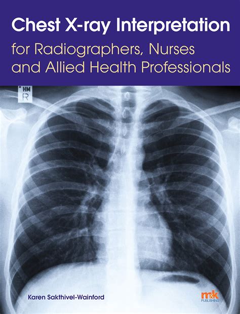 Chest X Ray Interpretation For Radiographers Nurses And Allied Health Professionals Pdf Epub