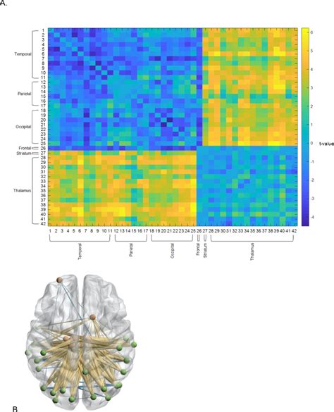 A Thalamo Cortical Subnetwork Identified About The Adsd Algorithm