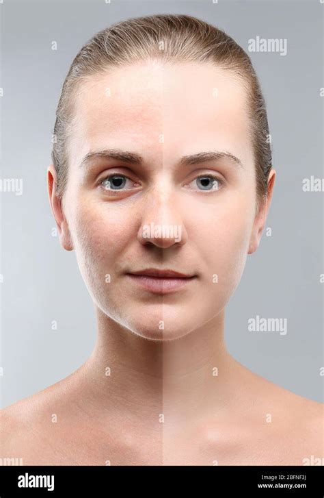 Woman Face Before And After Cosmetic Procedure Plastic Surgery Concept